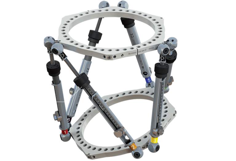 TL-HEX Product Info | Orthofix TL-HEX